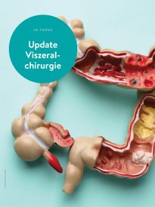 Update Rektumkarzinom - BDC|Online