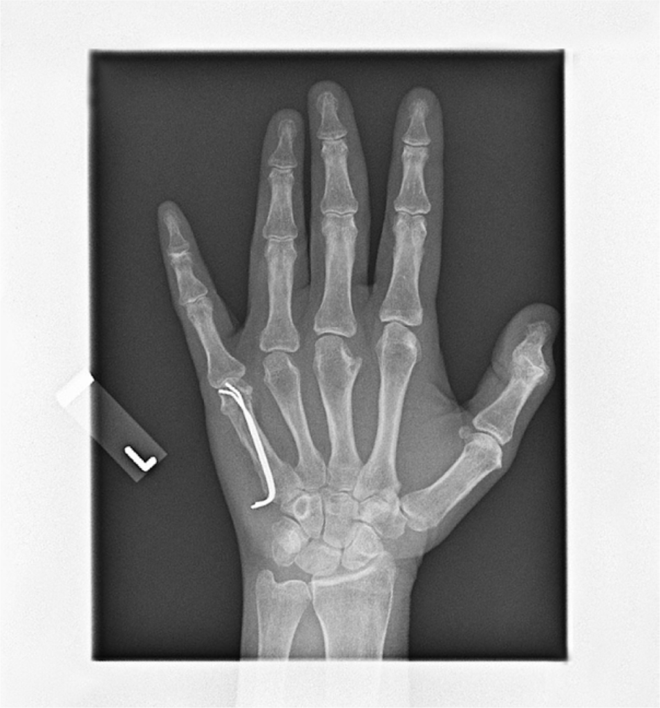 Osteosynthesen in der chirurgischen Praxis - BDC|Online