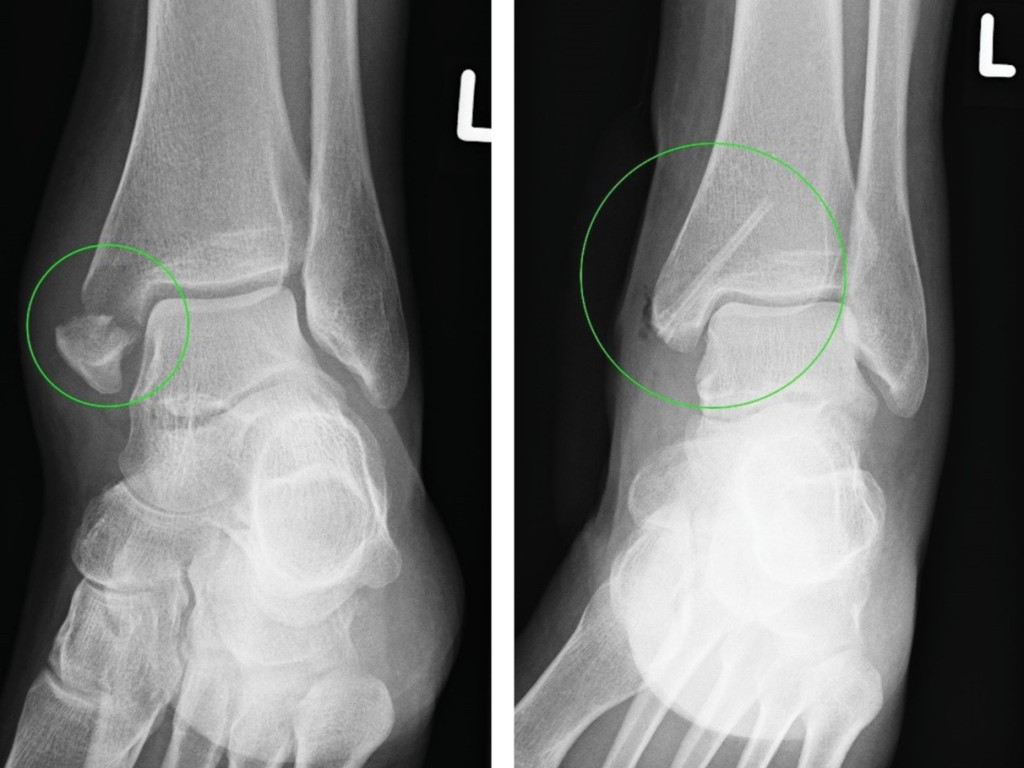Osteosynthesen in der chirurgischen Praxis - BDC|Online