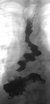 CME-Artikel: Der Thoraxmagen - BDC|Online