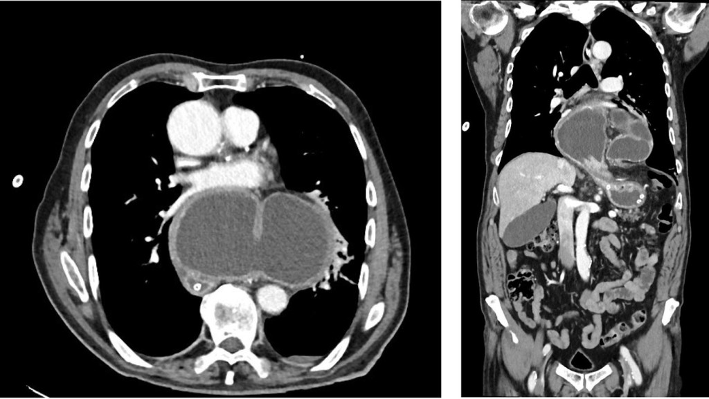 CME-Artikel: Der Thoraxmagen - BDC|Online