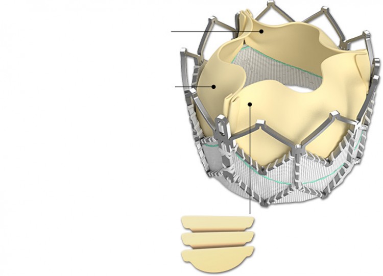 Herzchirurgie beim alten Patienten - BDC|Online